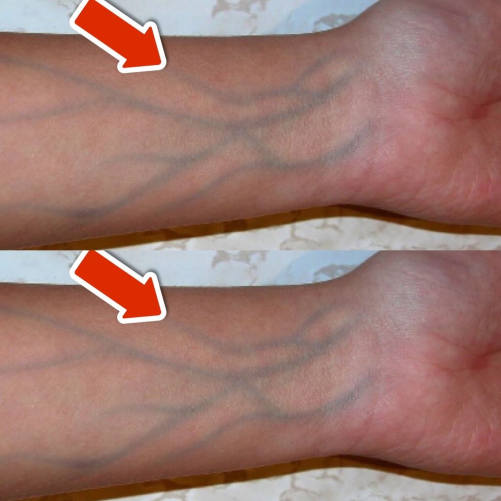 Never Ignore These 5 Indications Of Poor Circulation