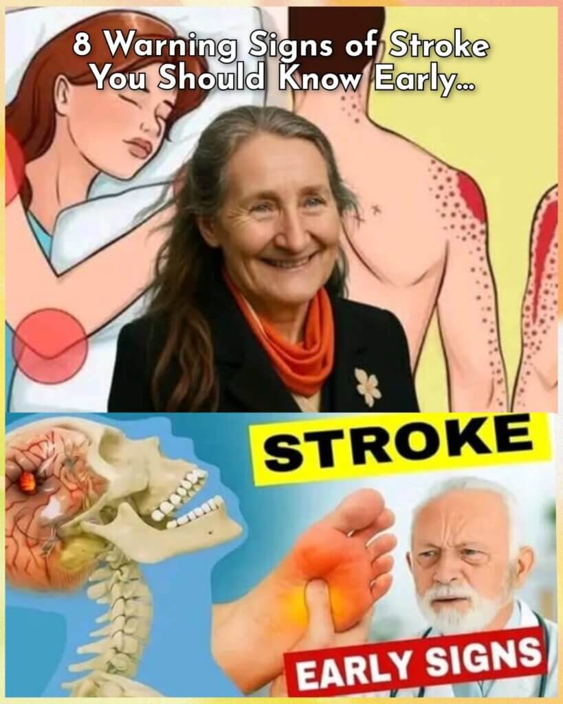 8 Warning Signs Of Stroke You Should Know Early